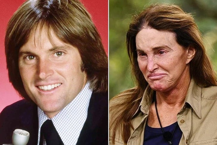 Antes y después [ Gente Wapa ] - Foro Coches